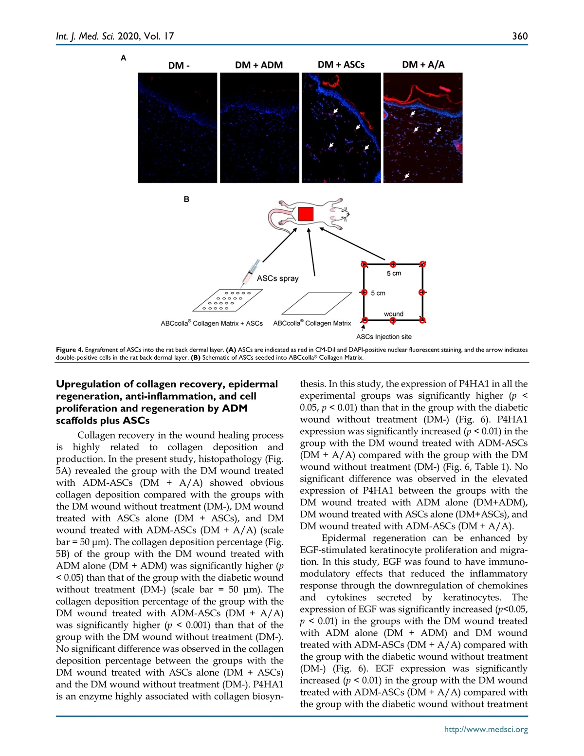 Supercritical Carbon Dioxide - decellularized Porcine Acellular Dermal Matrix combined with ...